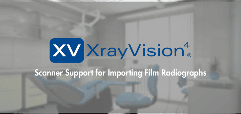 XrayVision® Scanner Support for Film Radiographs - Planet DDS