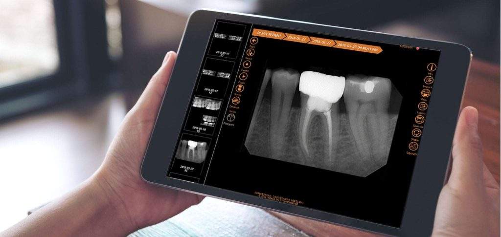 The Top 8 Benefits of Cloud Dental Model for Imaging - Planet DDS