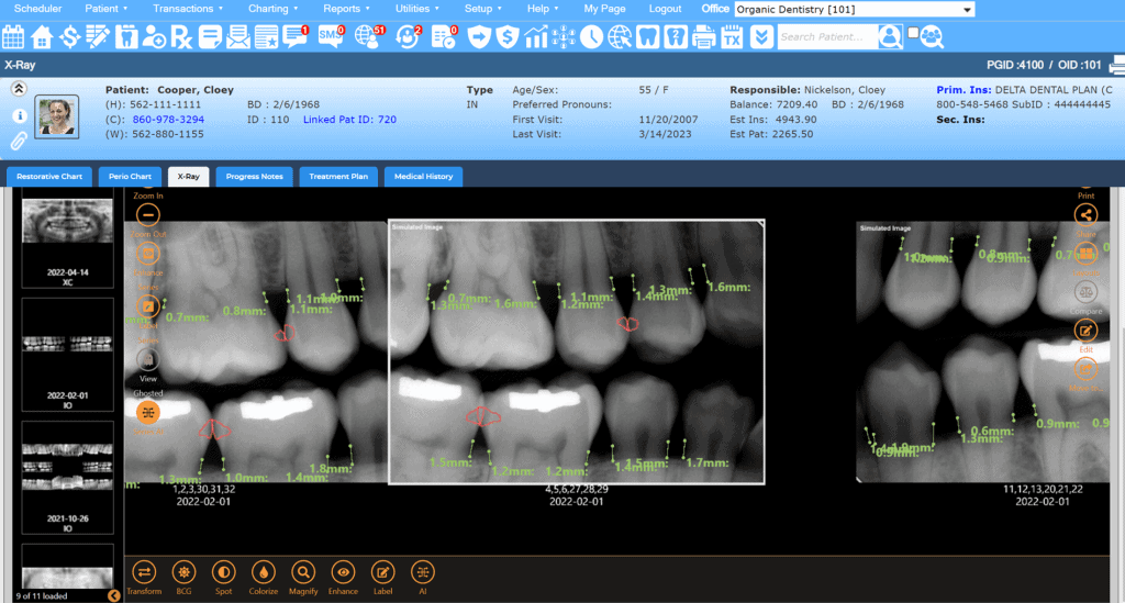 Denticon Dental Practice Management Software - Planet DDS
