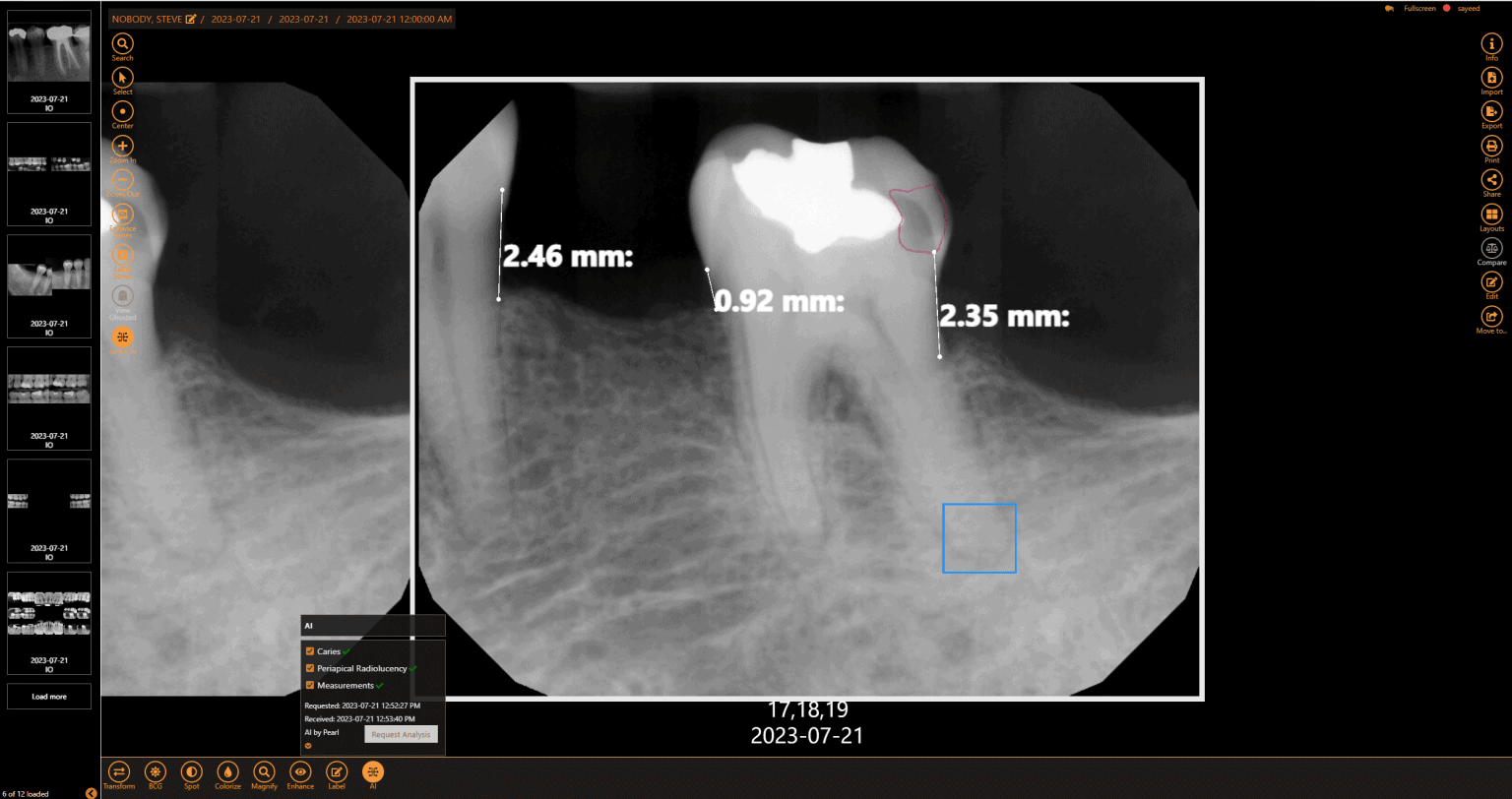 Dental Imaging AI Now Available From Planet DDS