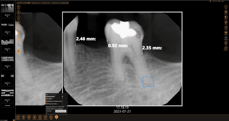 Dental Imaging AI Now Available From Planet DDS