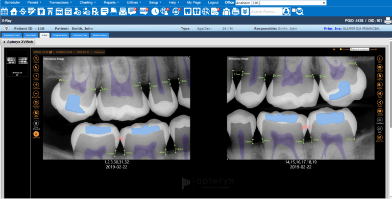 Apteryx | Advanced Dental Imaging Software by Planet DDS