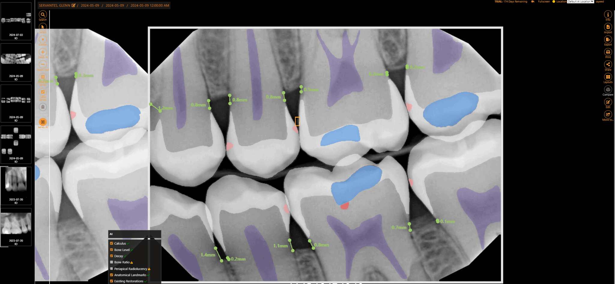 Apteryx | Advanced Dental Imaging Software by Planet DDS